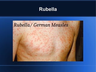Rash differential Diagnosis of Infectious diseases | PPT