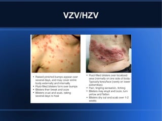 Rash differential Diagnosis of Infectious diseases | PPT