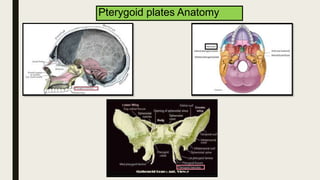 PTERYGOID HAMULUS SYNDROME- A CASE REPORT | PPT