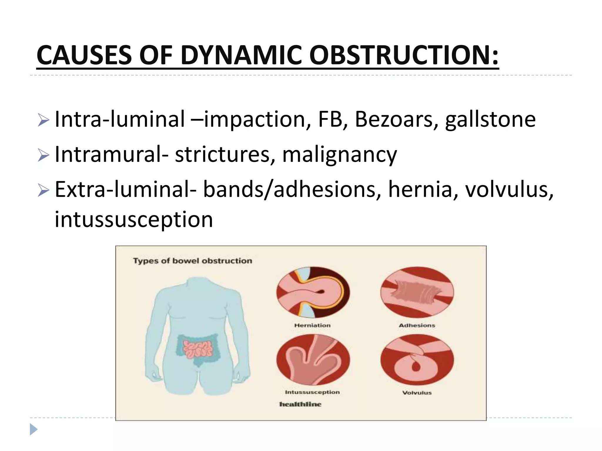 Presentation Intestinal obstruction.pptx ...