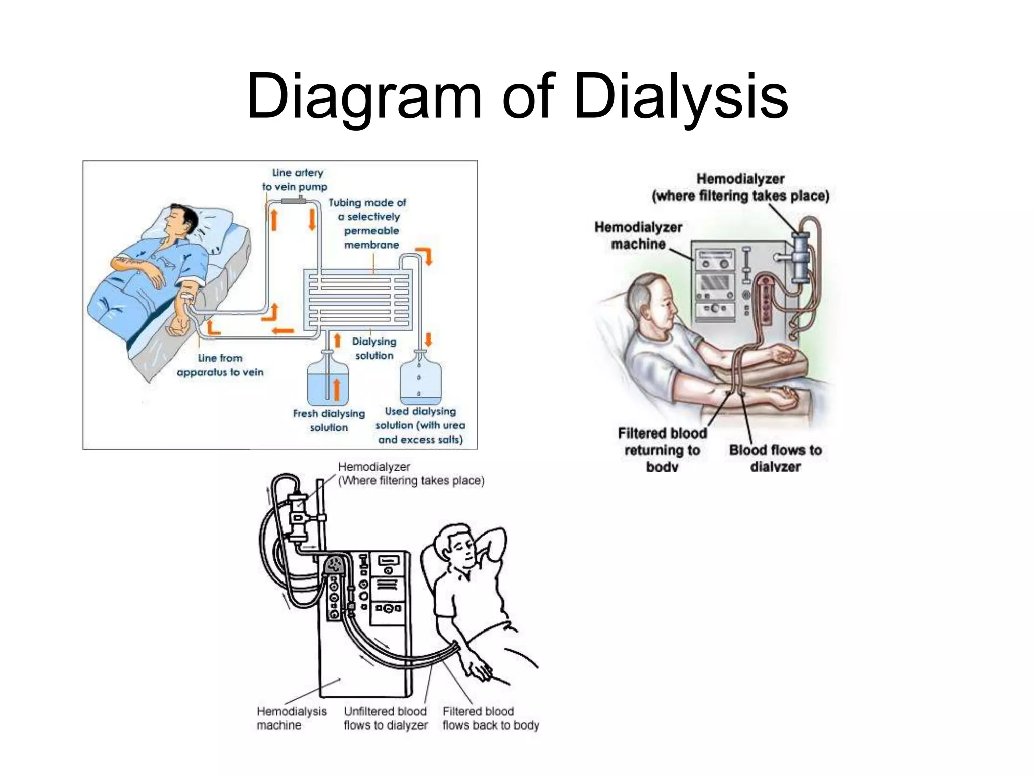Presentation kidney | PPTX