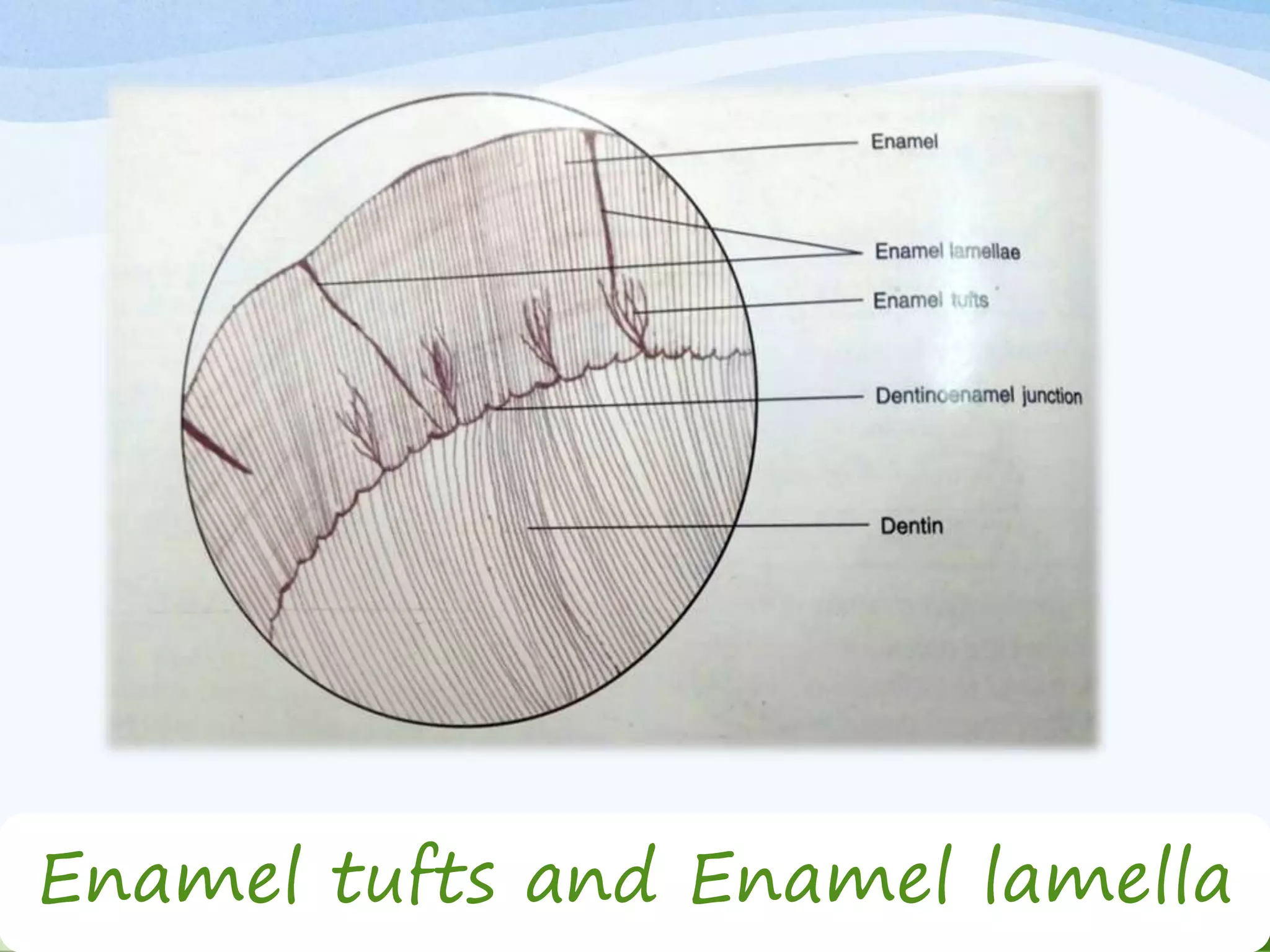 Hypomineralised structure of enamel | PPTX