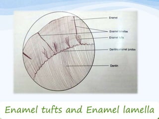 Hypomineralised structure of enamel | PPTX