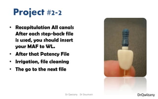 root canal treatment of plastic maxillary first premolar | PDF