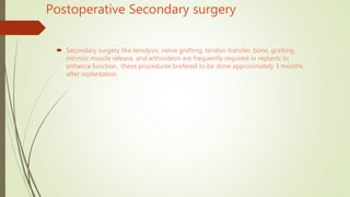 Replantation basics | PPTX