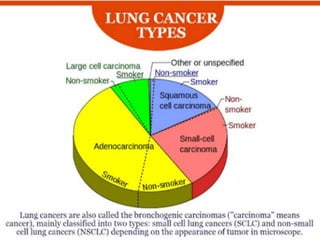 Presentation lung | PPT