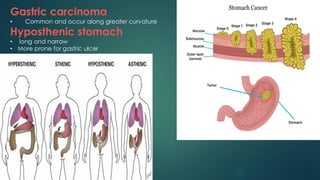 Human stomach anatomy (feature, shape, size, etc) | PDF