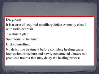 Presentation maxillarydefect | PPT