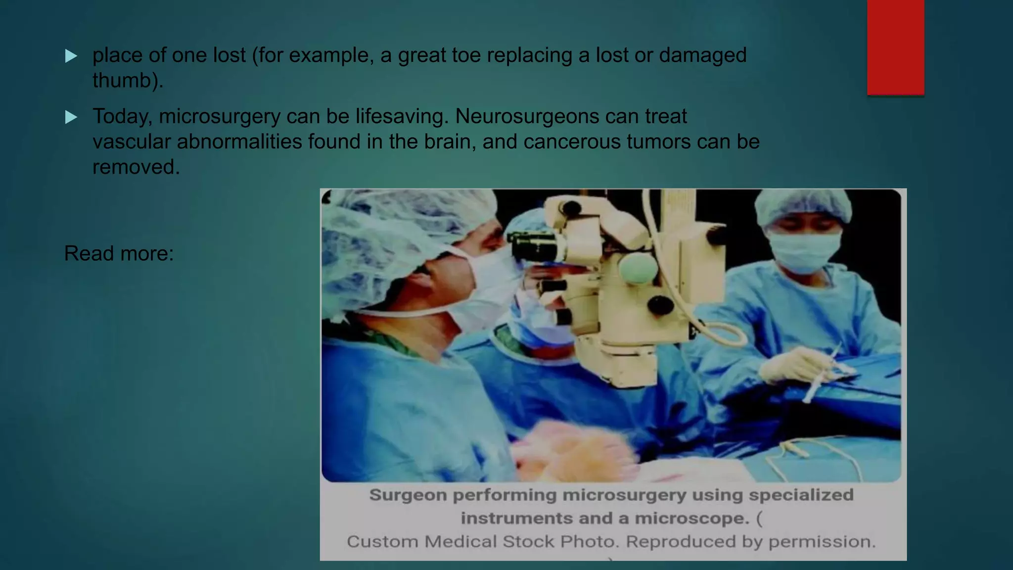 Presentation microsurgery | PPTX