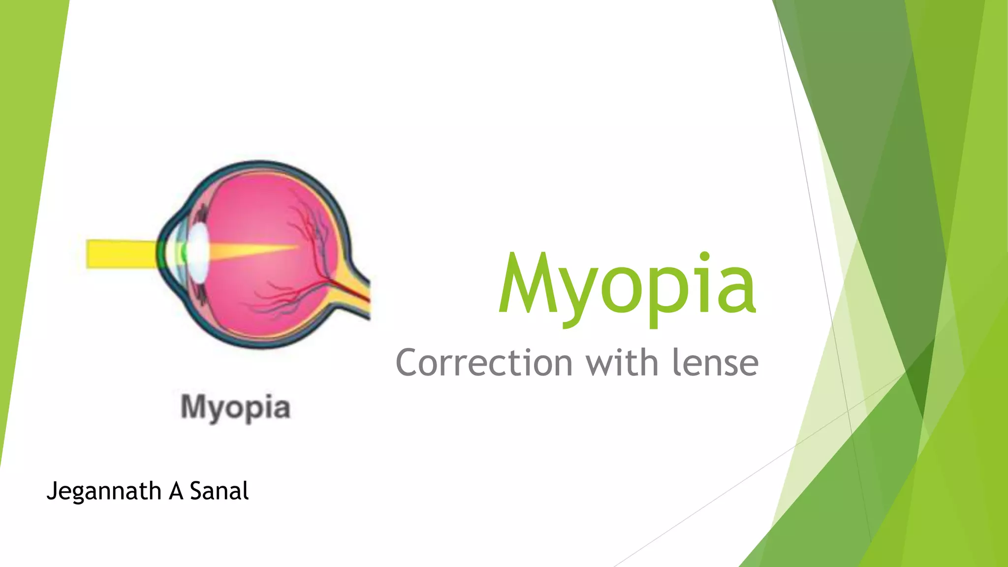 Myopia.pptx