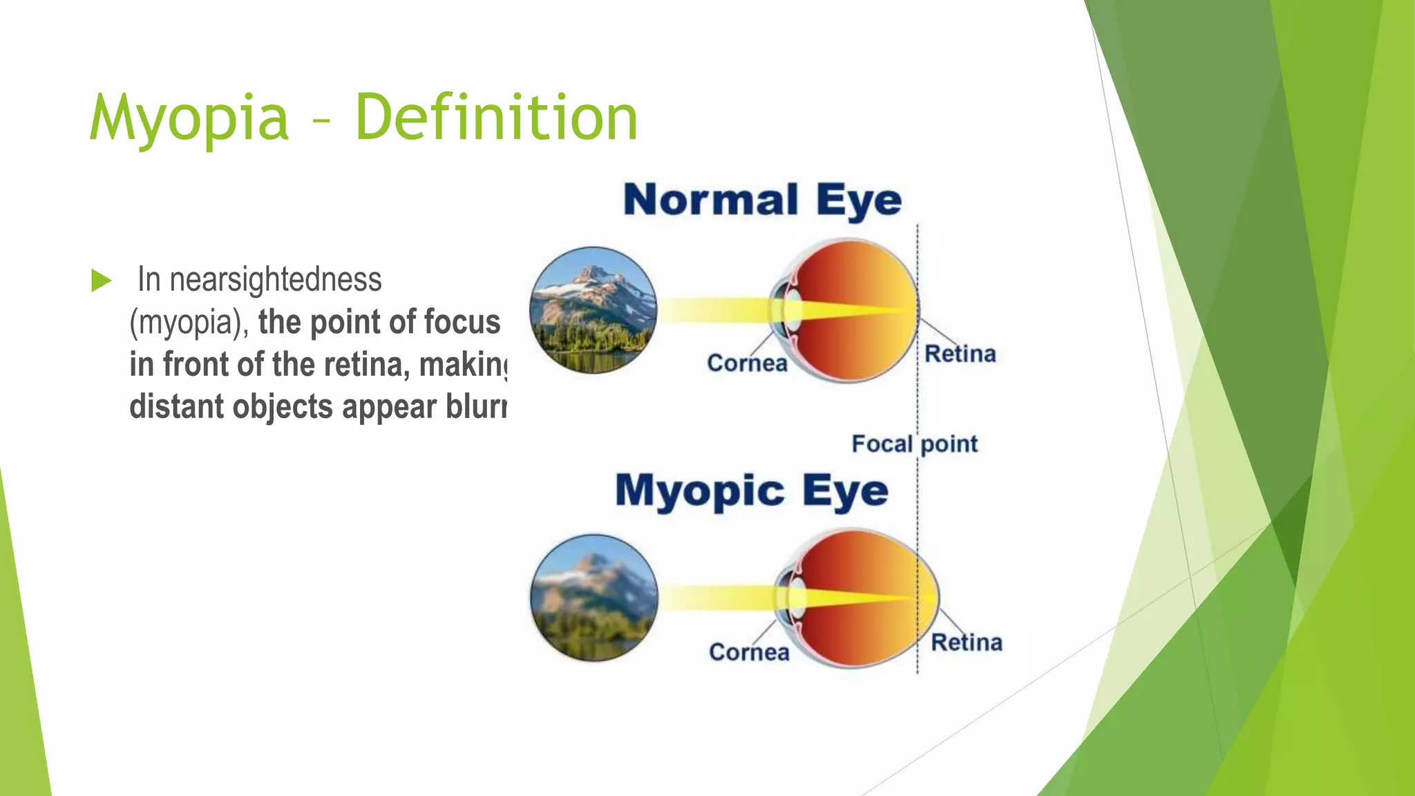 Myopia.pptx