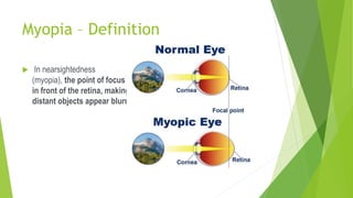 Myopia.pptx
