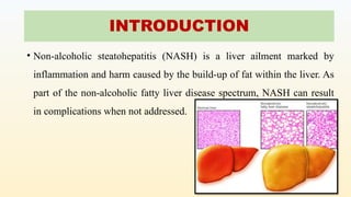 PRESENTATION NASH.pptx..................... | PPTX