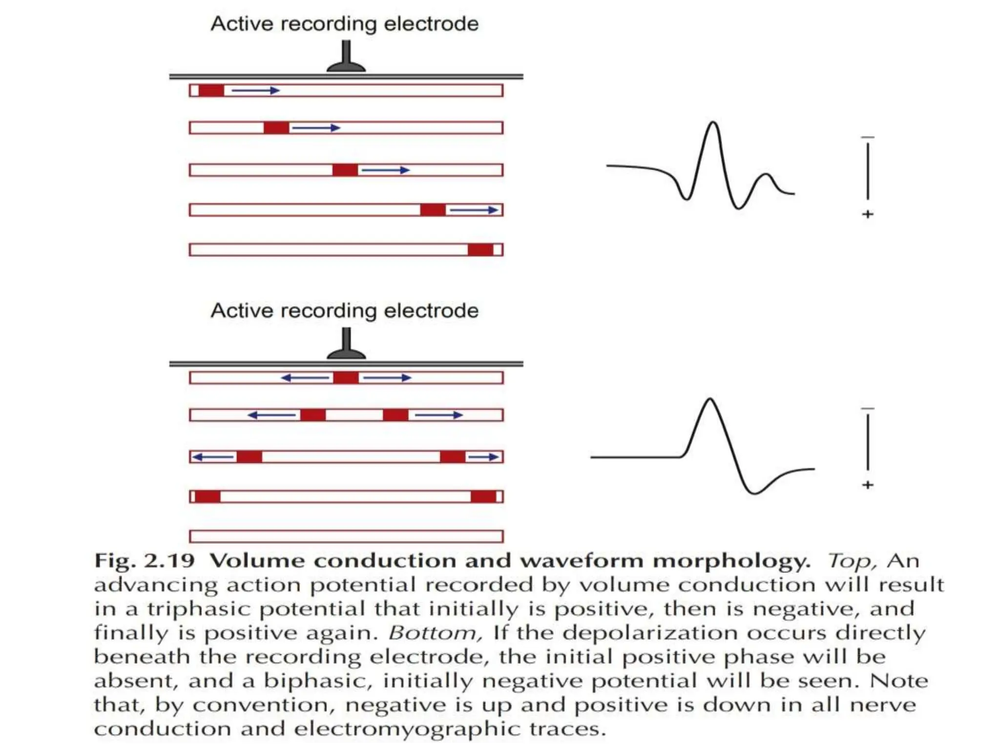 Basic overview of nerve conduction studies | PPTX