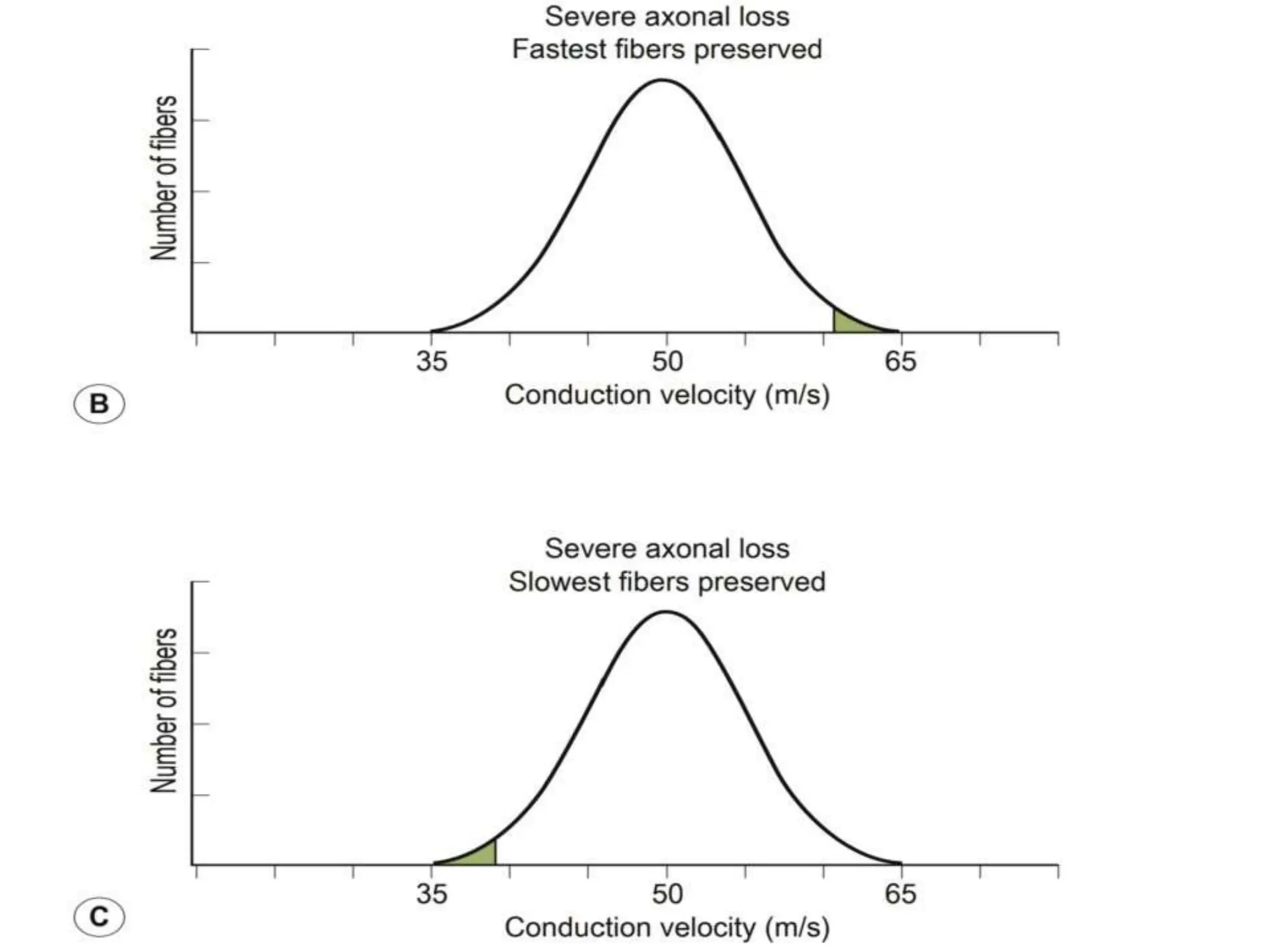 Basic overview of nerve conduction studies | PPTX