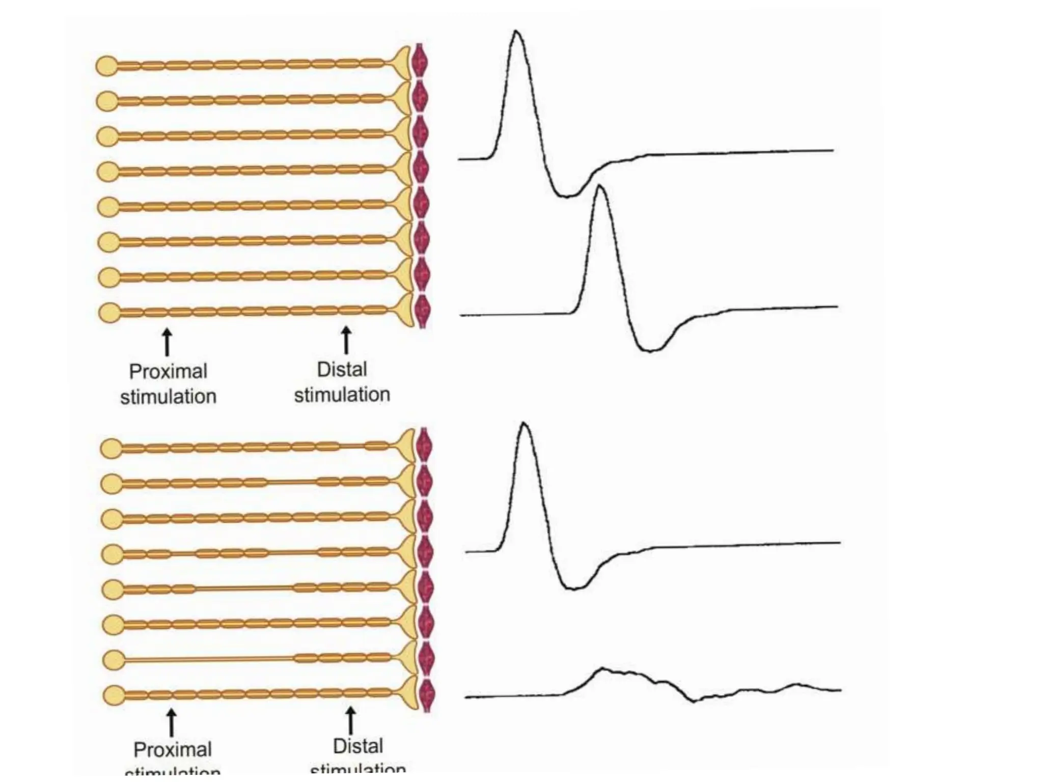 Basic overview of nerve conduction studies | PPTX