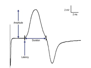 Basic overview of nerve conduction studies | PPTX