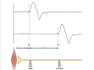 Basic overview of nerve conduction studies | PPTX