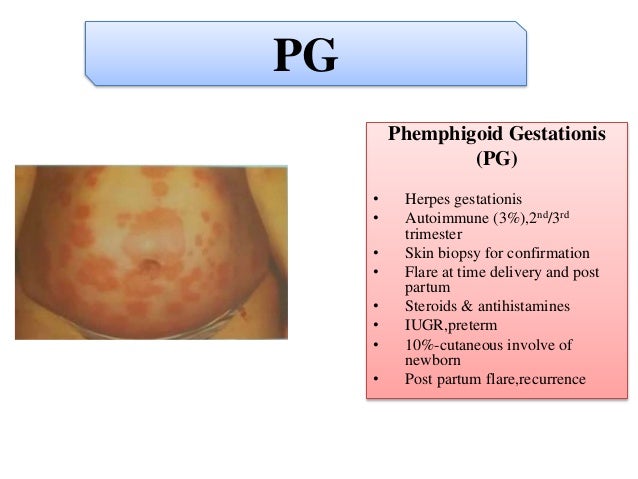 Pruritus in pregnancy