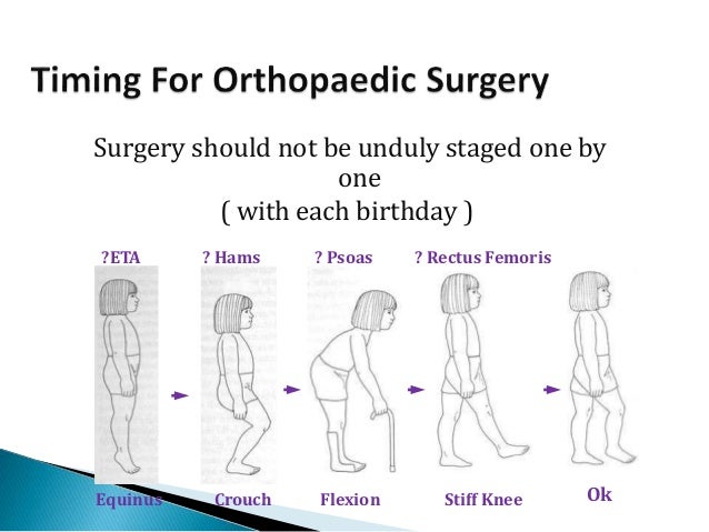 Presentation of cerebral palsy