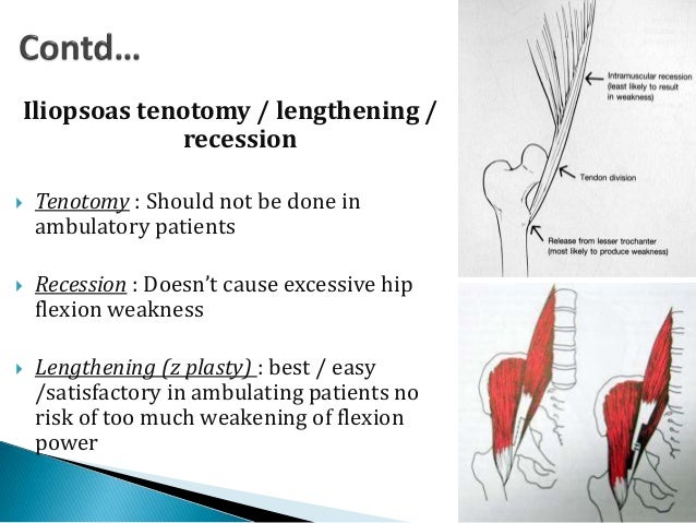 Presentation of cerebral palsy