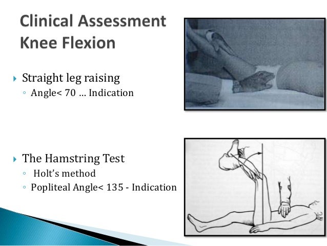 Presentation of cerebral palsy