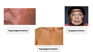 Presentation of Dermatosis/Skin Disease .pptx