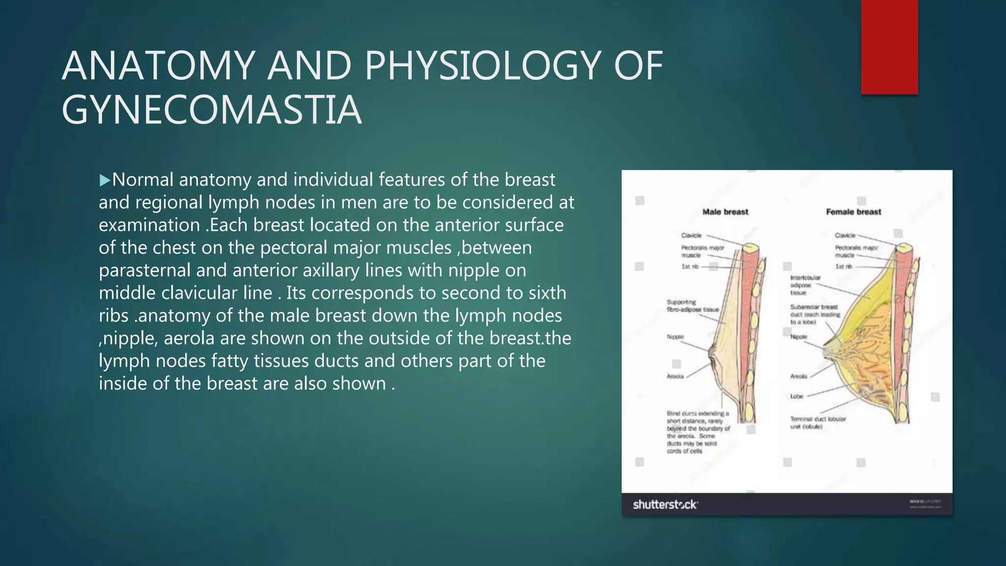presentation of gynecomastia MSN-I sam (3).pptx