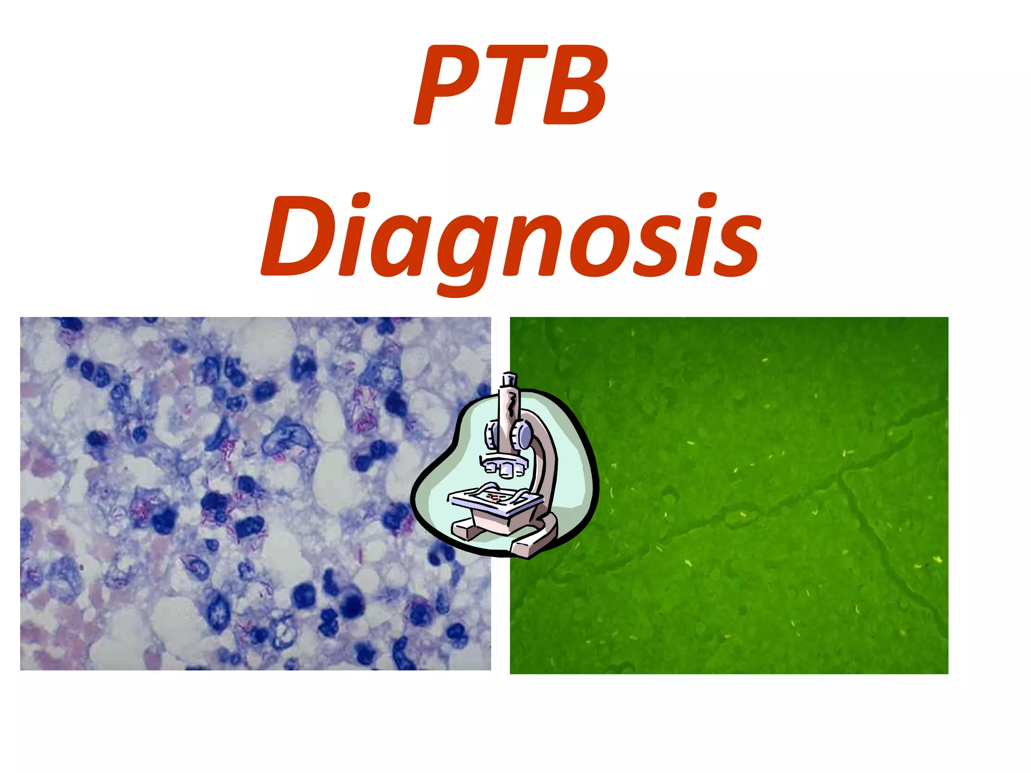 Presentation of laboratory diagnosis of tb final research | PPTX