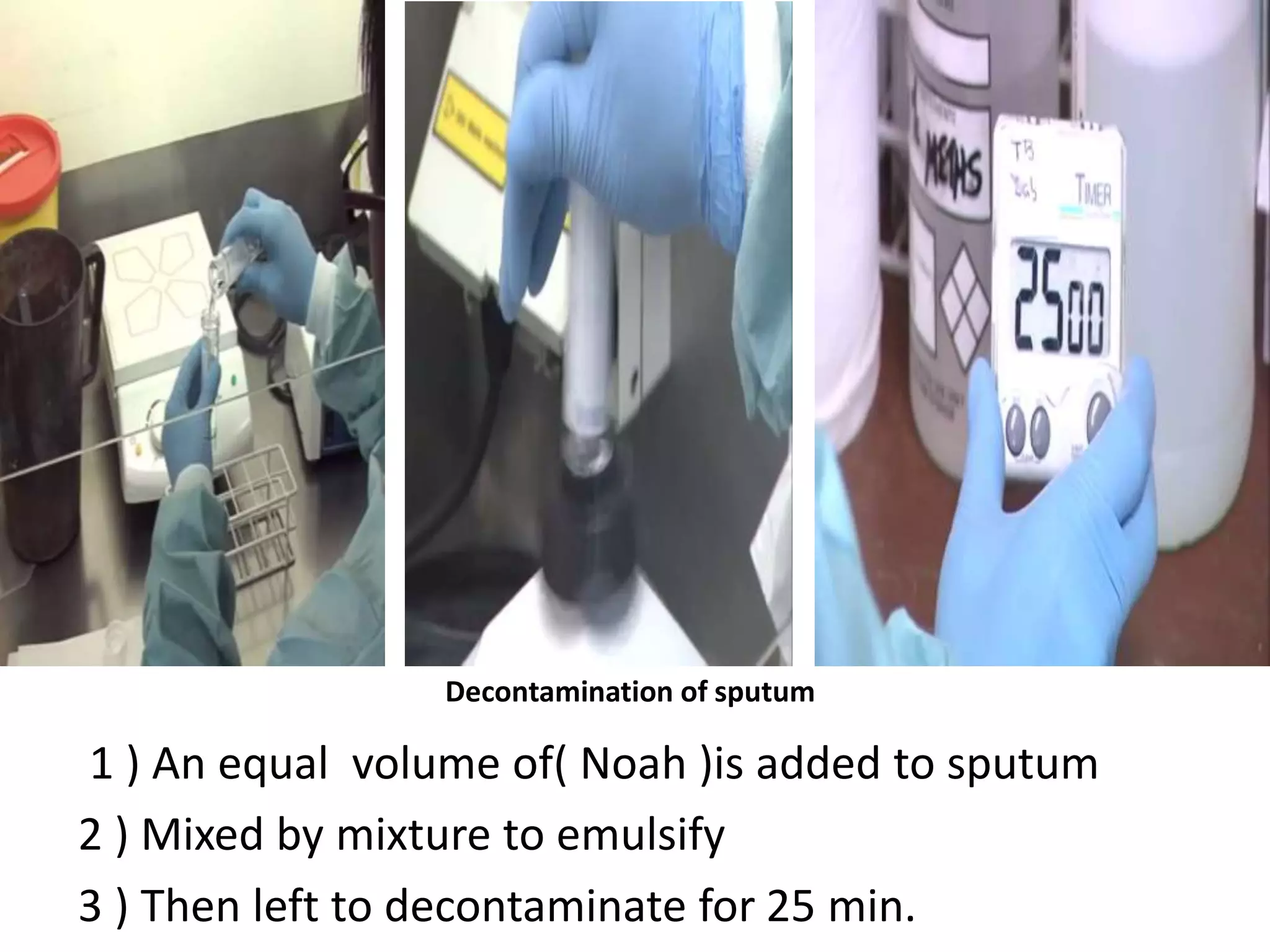 Presentation of laboratory diagnosis of tb final research | PPTX