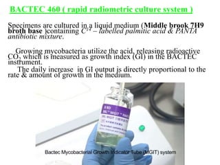 Presentation of laboratory diagnosis of tb final research | PPTX