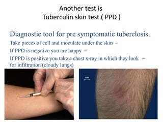 Presentation of laboratory diagnosis of tb final research | PPTX