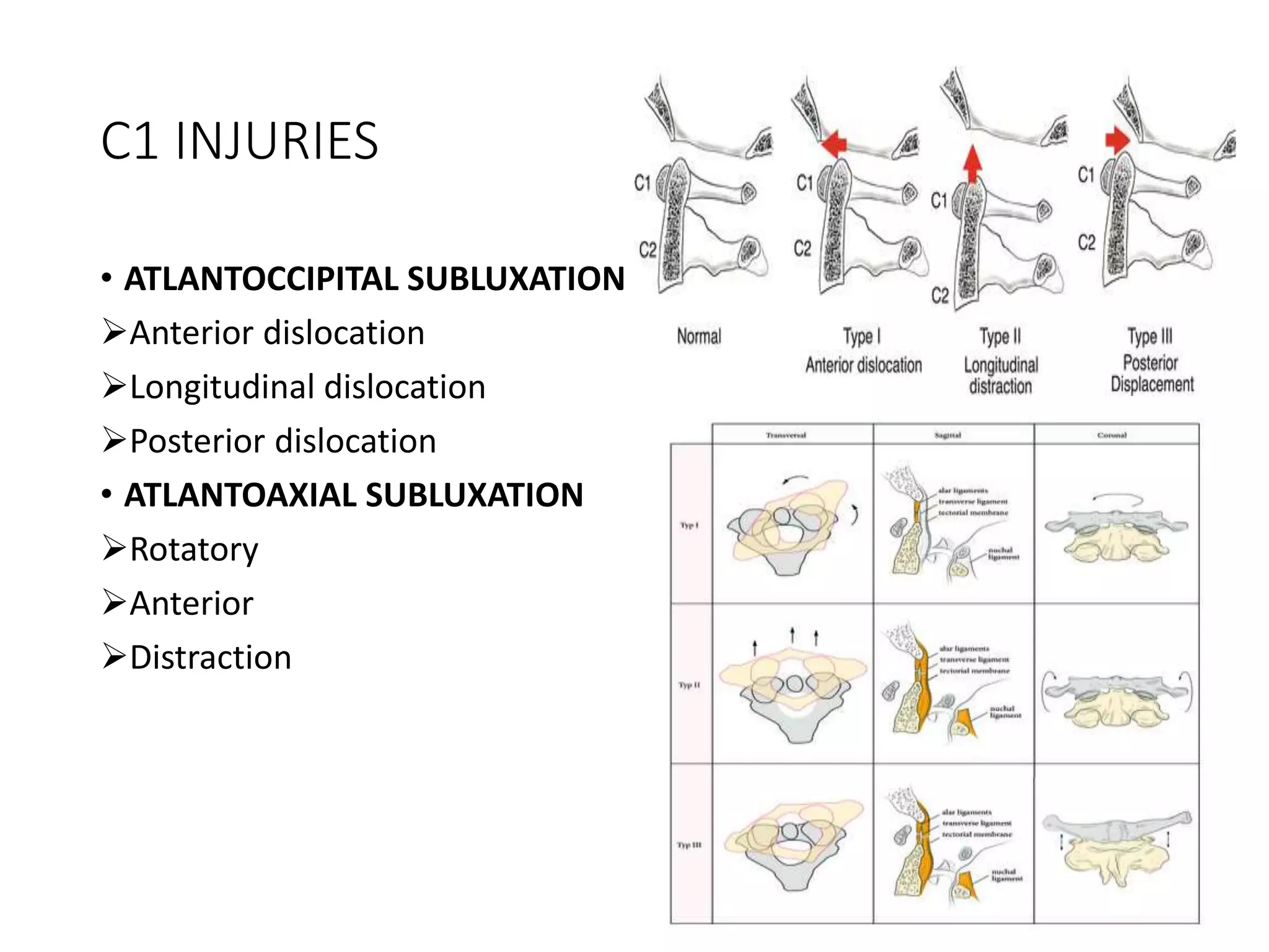 PRESENTATION OF SPINE INJURY BY DR.MUMTAZ ALI.ppt
