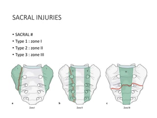 PRESENTATION OF SPINE INJURY BY DR.MUMTAZ ALI.ppt