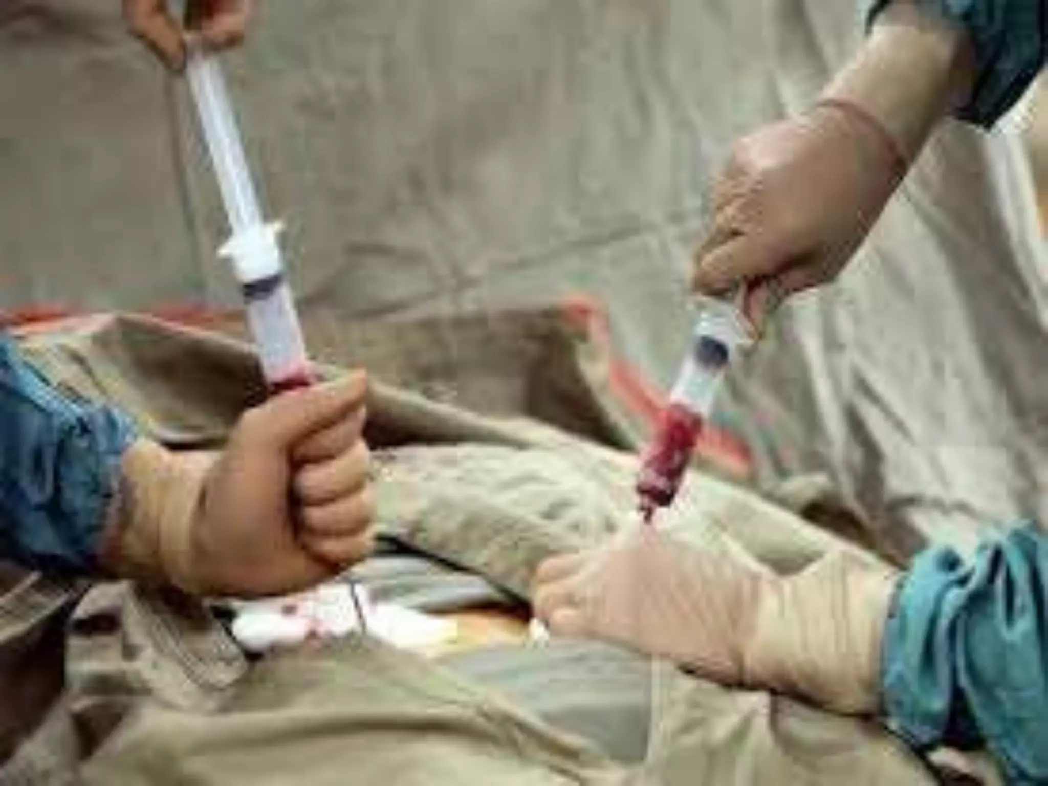 Presentation of stem cell and bone marrow tranplan tation | PPTX