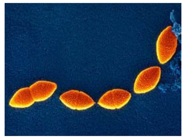Presentation of streptococcus | PPTX