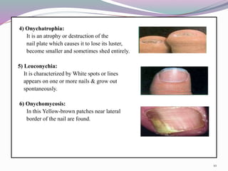 Presentation of transungual | PPTX | Nail Care | Beauty