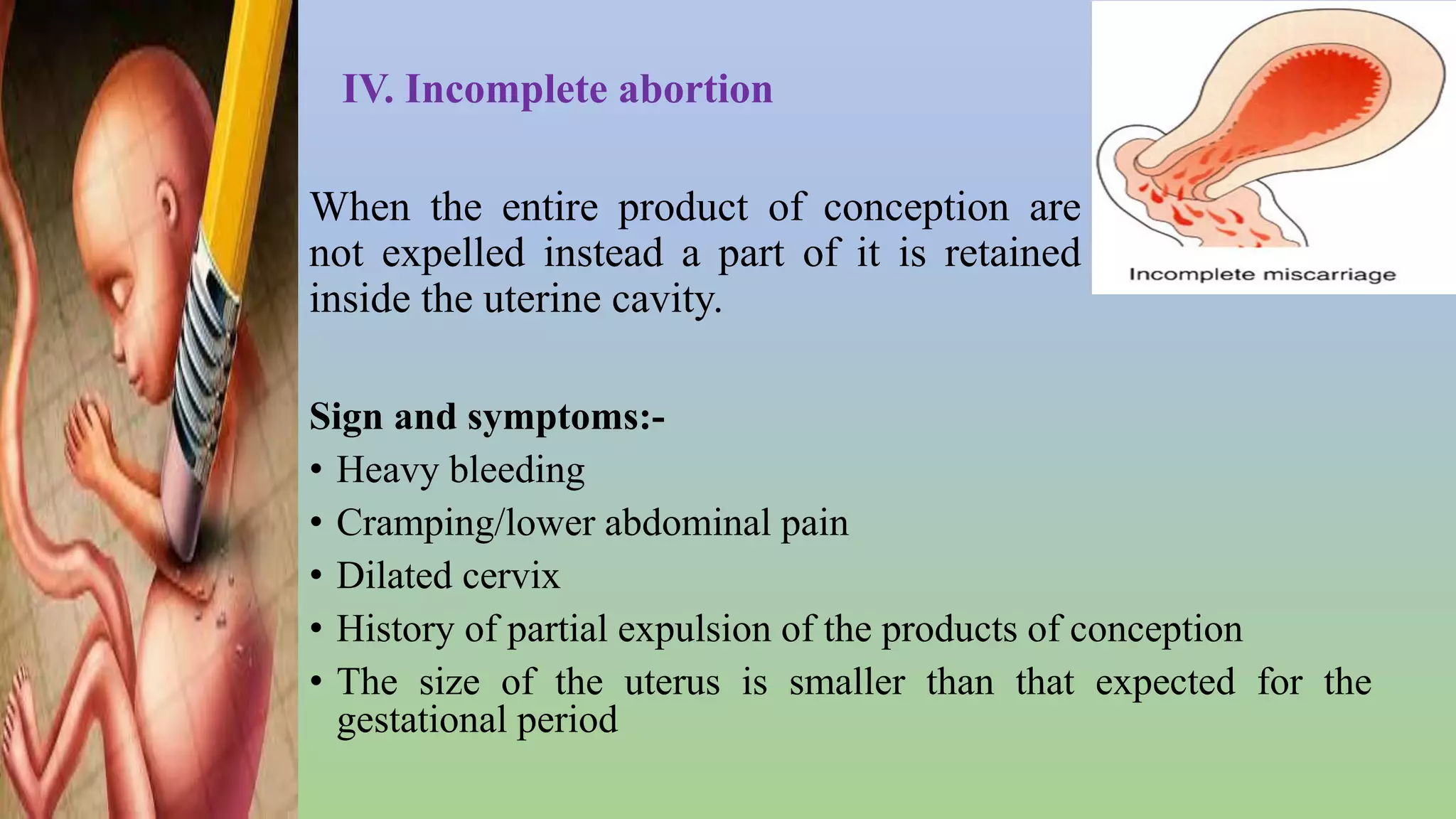 Presentation on abortion | PDF