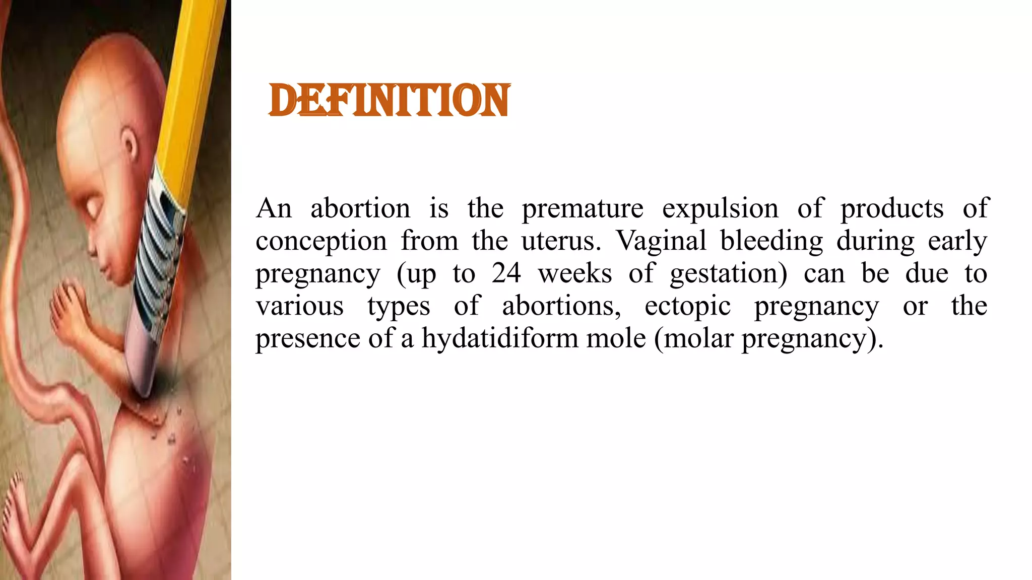 Presentation on abortion | PDF