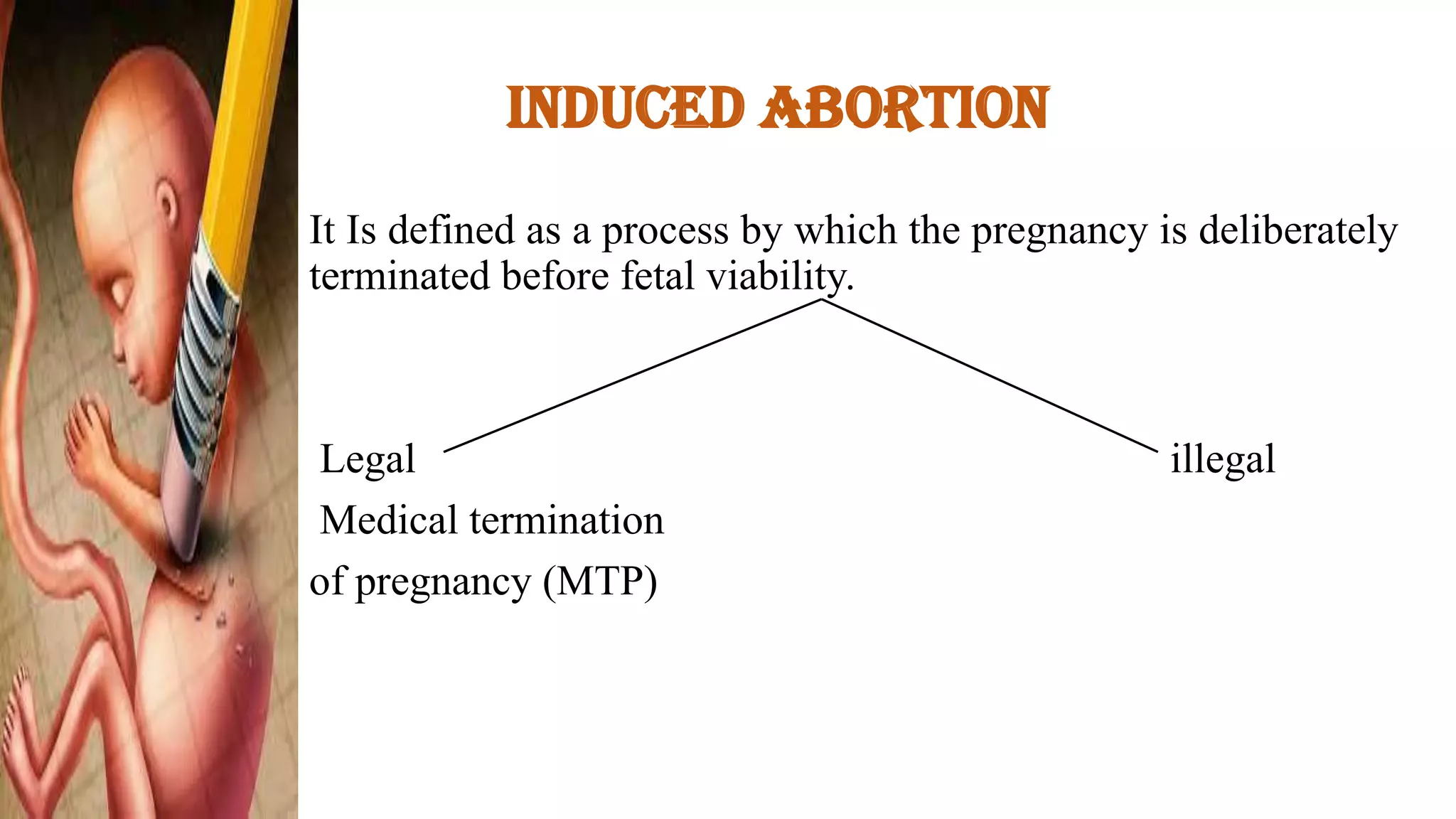 Presentation on abortion | PDF