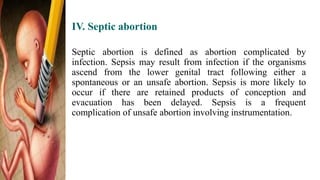 Presentation on abortion | PDF