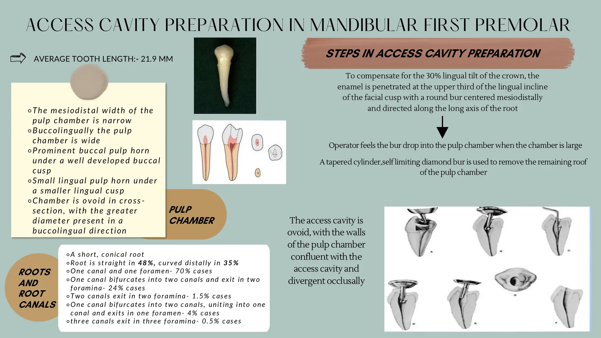 Presentation on Access Cavity Preparation in Premolars (Maxillary and ...