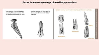 Presentation on Access Cavity Preparation in Premolars (Maxillary and ...