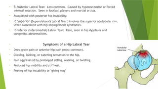 PRESENTATION ON ACUTE AND OVERUSE INJURIES OF HIP.pptx
