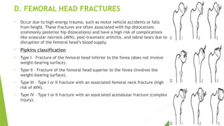 PRESENTATION ON ACUTE AND OVERUSE INJURIES OF HIP.pptx