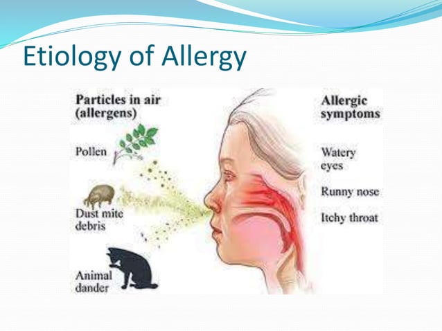Presentation on allergic rhinitis.pptx | Free Download