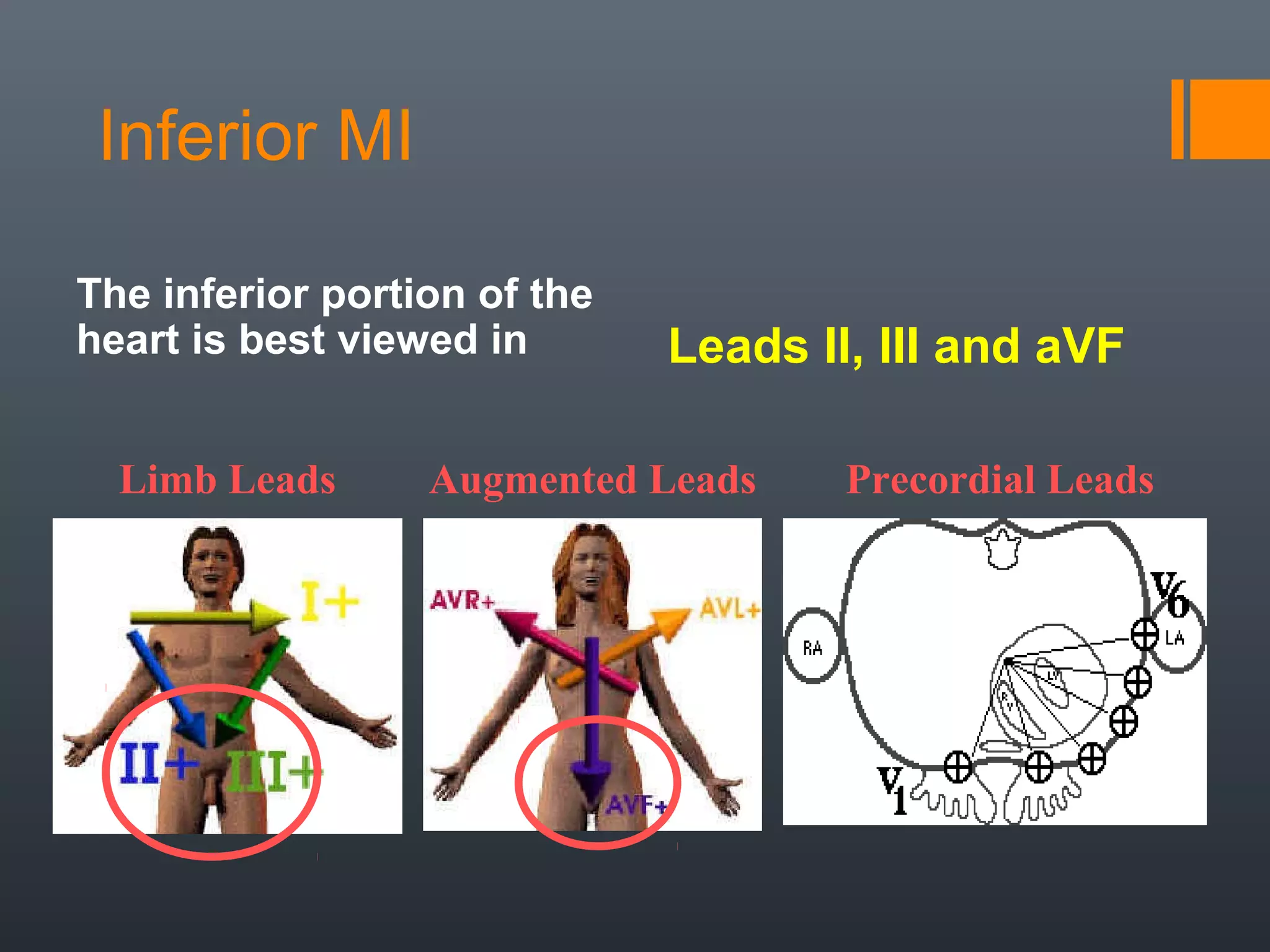Presentation on anatomy of heart ,coronary circulation ,mi and ecg ...