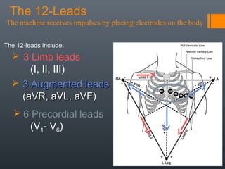 Presentation on anatomy of heart ,coronary circulation ,mi and ecg ...