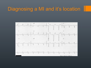 Presentation on anatomy of heart ,coronary circulation ,mi and ecg ...