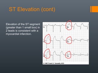 Presentation on anatomy of heart ,coronary circulation ,mi and ecg ...